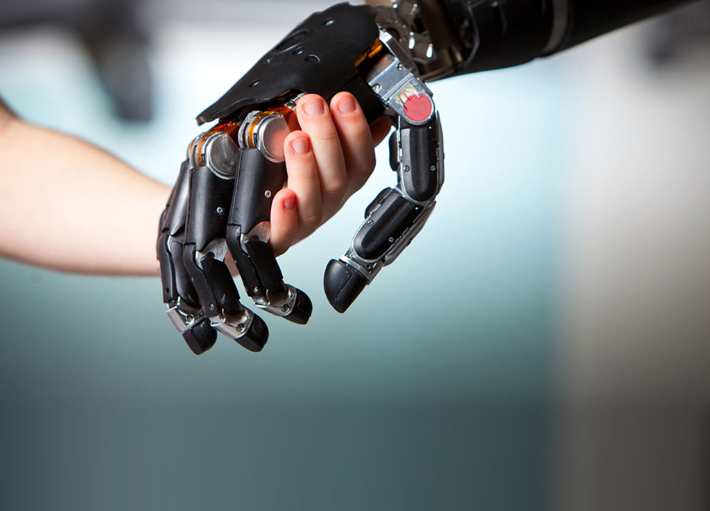 Orang Pertama yang Hidup dengan Lengan Robot Terkendali - ikons.id