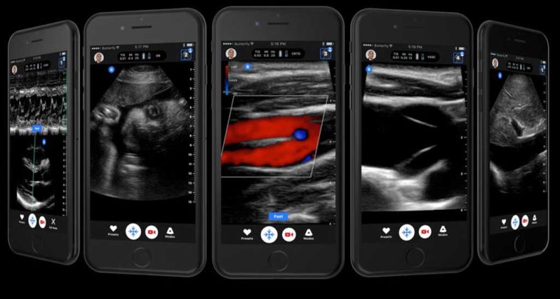 USG Mini Portable yang Terhubung ke Smartphone - ikons.id